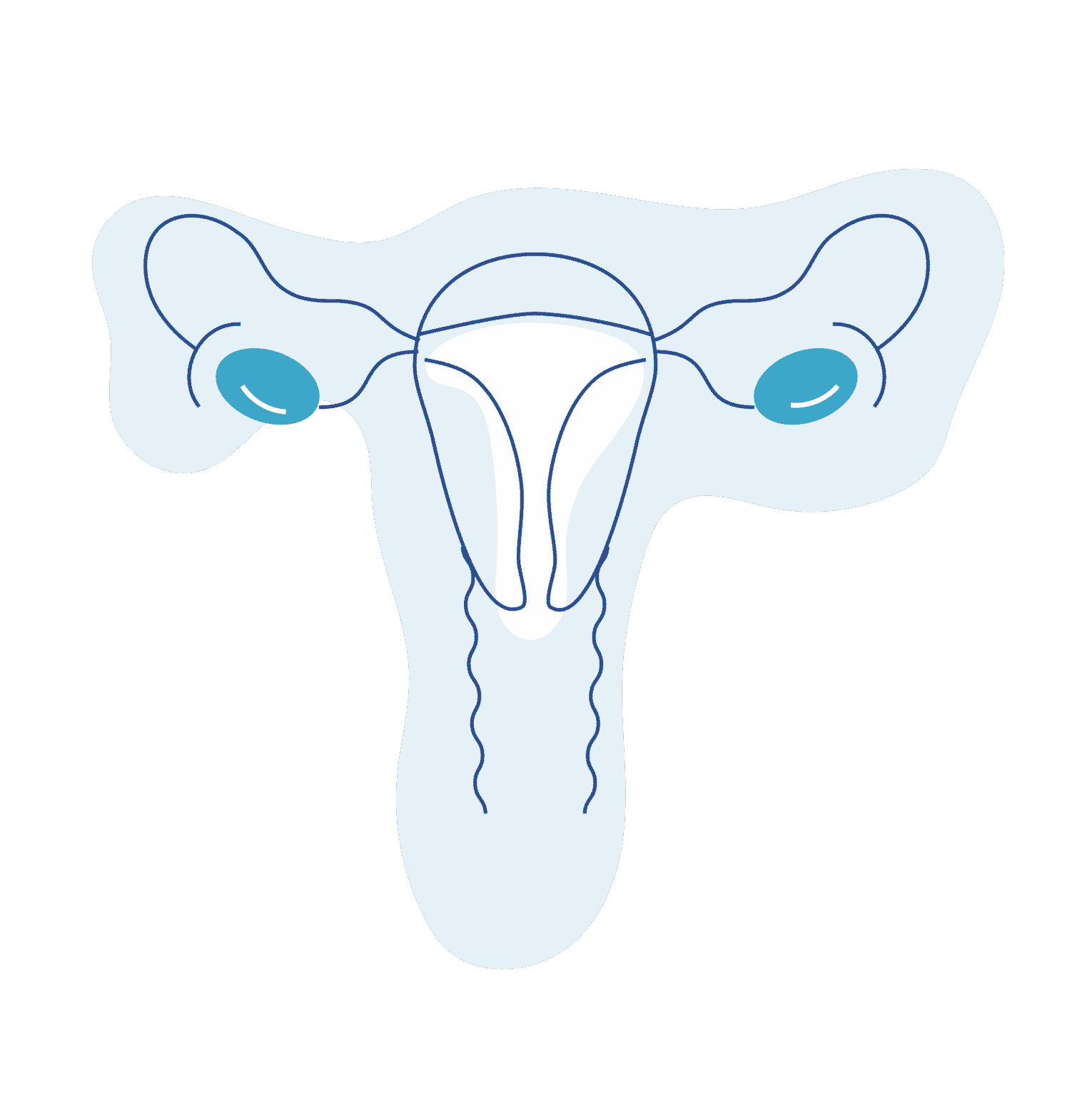 Ovaire - Cancer Consult